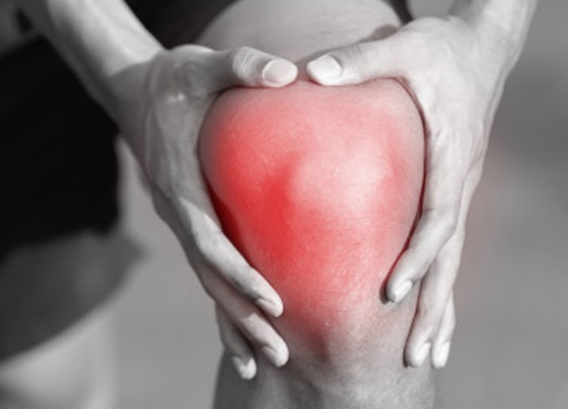 Condromalacia Rotuliana o Condropatía Rotuliana / Fisioterapia en MAD Y BCN