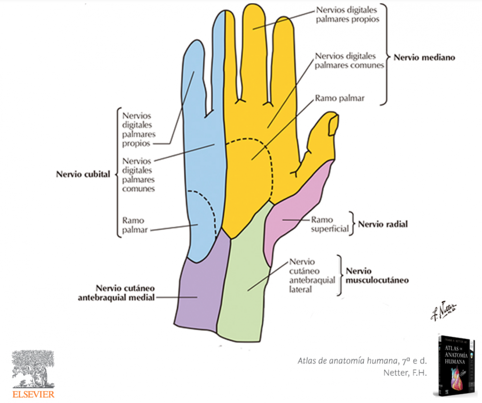 Atrapamiento del Nervio Mediano 5 claves - FISIO MAD / BCN